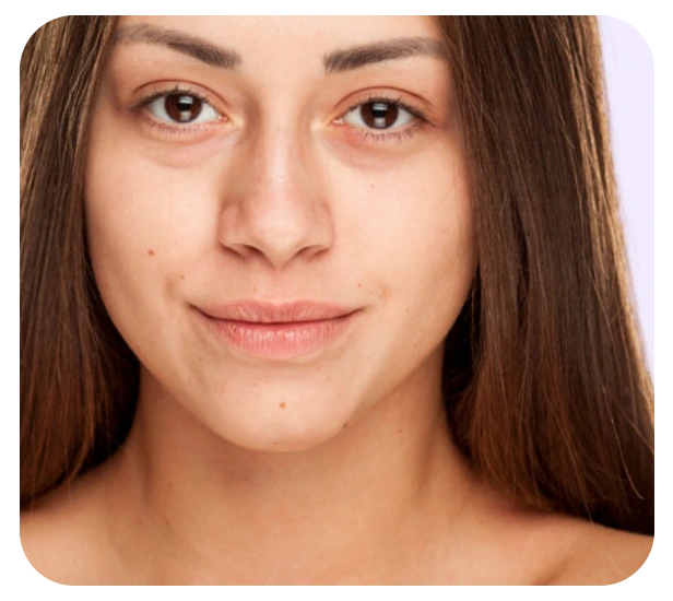 Expert Dull Skin Treatment in Portsmouth, NH | Skin Rejuvenation